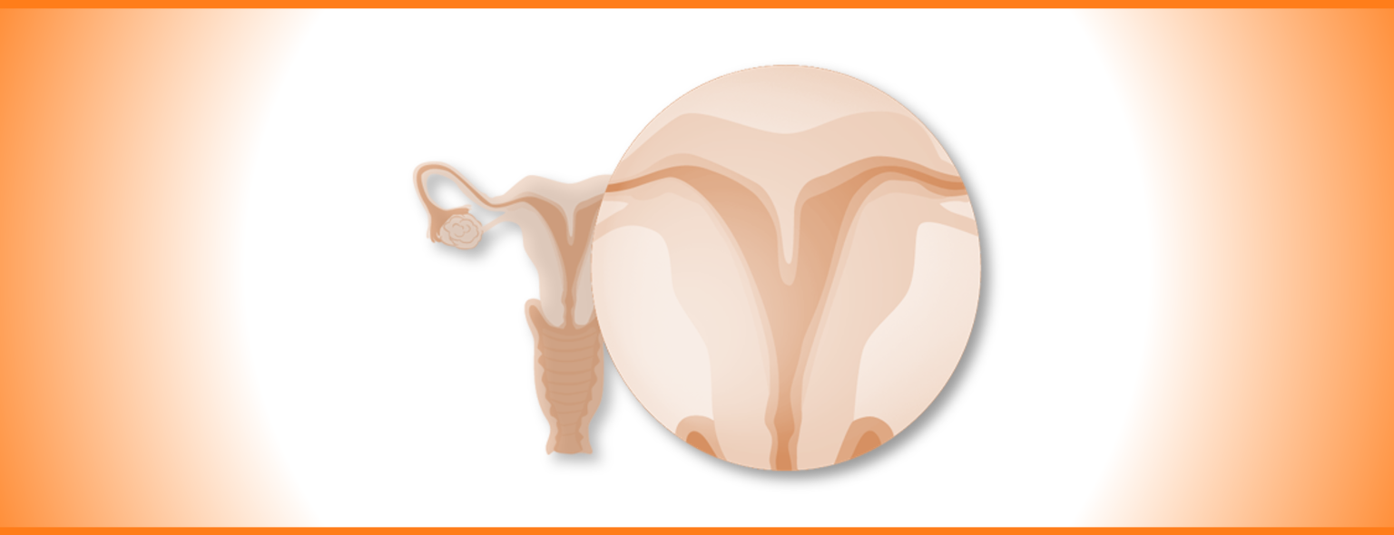 Categoria – Endoscopia ginecológica – GinecoAcademy